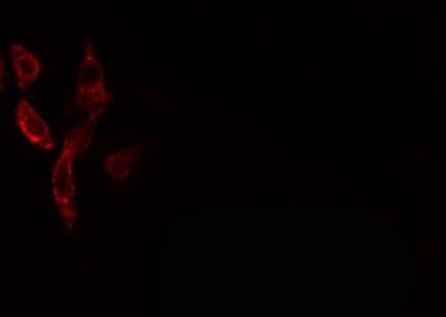 VASH1 Polyclonal Antibody, Invitrogen 100 μL; Unconjugated:Antibodies ...