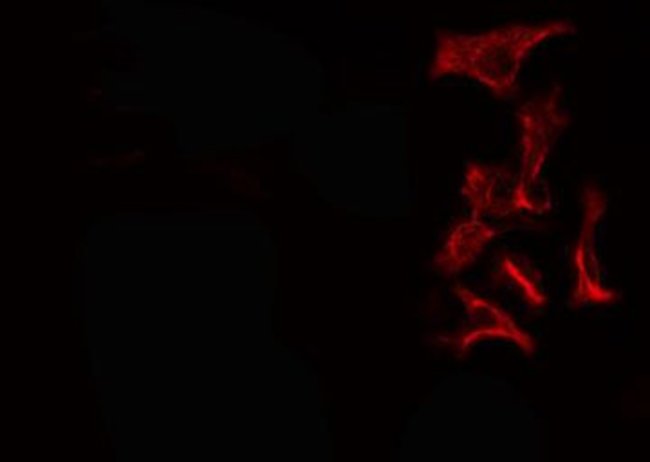 TGF alpha Polyclonal Antibody, Invitrogen 100 μL; Unconjugated ...