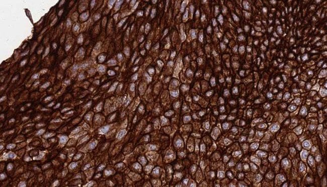 TGF alpha Polyclonal Antibody, Invitrogen 100 μL; Unconjugated ...
