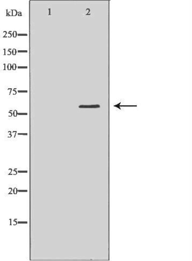Factor IX Polyclonal Antibody, Invitrogen™ 100 μL; Unconjugated ...
