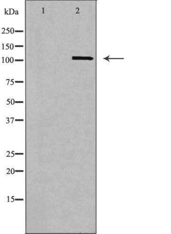 Cbl-b Polyclonal Antibody, Invitrogen 100 μL; Unconjugated:Antibodies ...