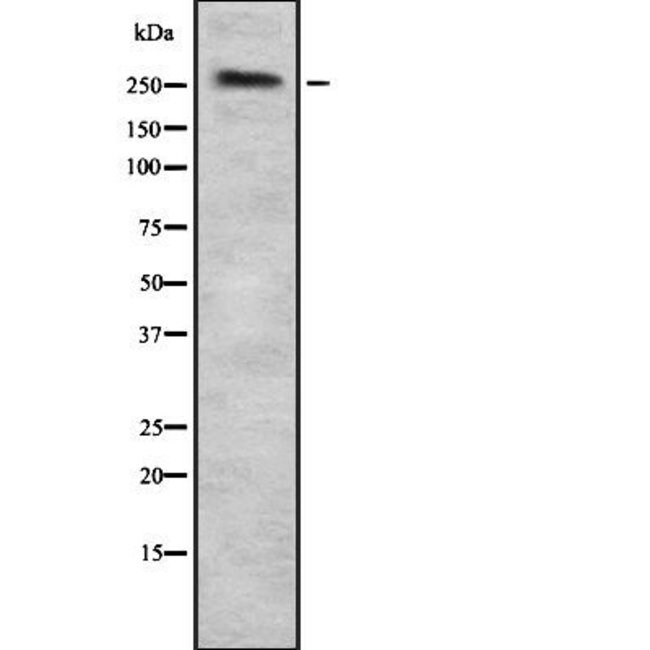 Invitrogen alpha-II Spectrin Polyclonal Antibody 100 μL; Unconjugated ...