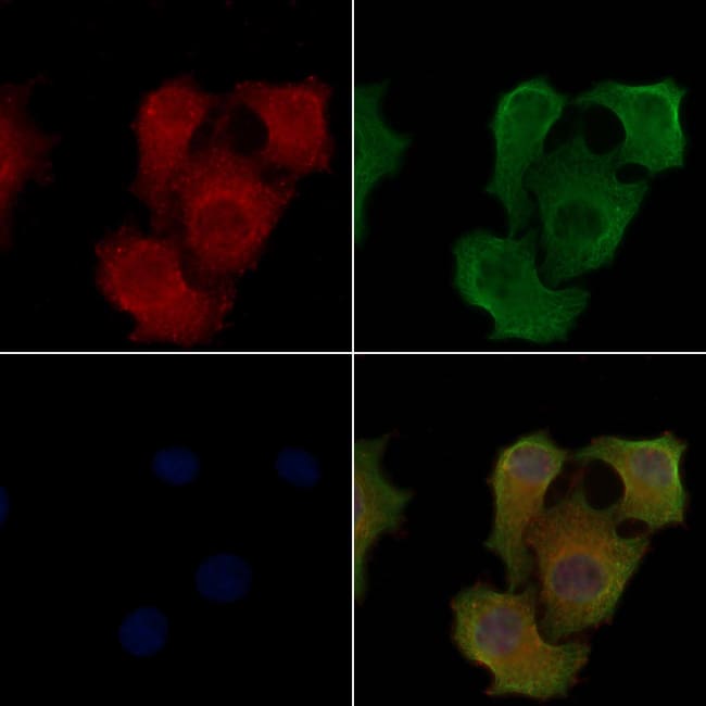 ORM2 Polyclonal Antibody, Invitrogen 100 μL; Unconjugated:Antibodies ...