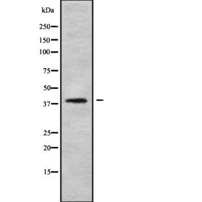 PDCD2 Polyclonal Antibody, Invitrogen™ 100 μL; Unconjugated | Fisher ...