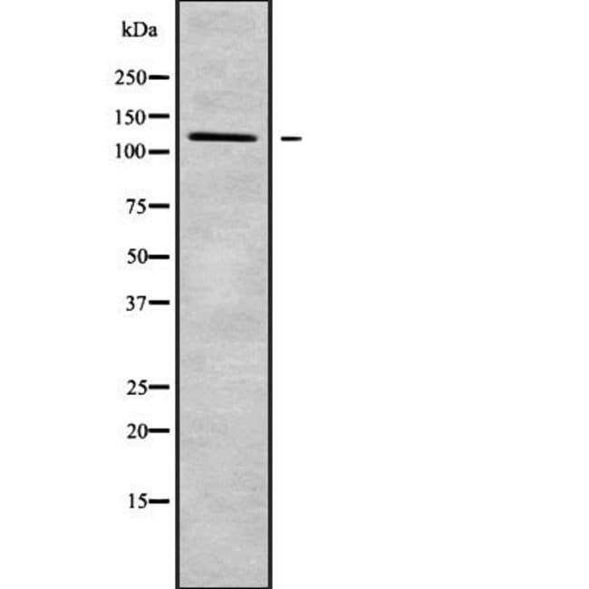 Invitrogen Desmoglein 4 Polyclonal Antibody 100 μL; Unconjugated ...