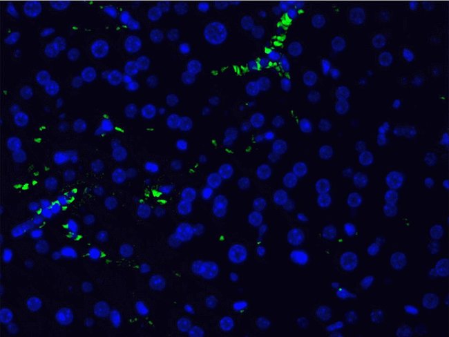 Phospho-PI3K p85 alpha (Tyr607) Polyclonal Antibody, Invitrogen 100 μL ...