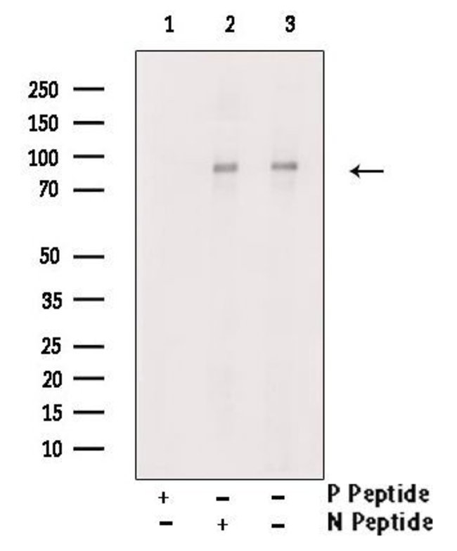 Phospho-PI3K p85 alpha (Tyr607) Polyclonal Antibody, Invitrogen 100 μL ...