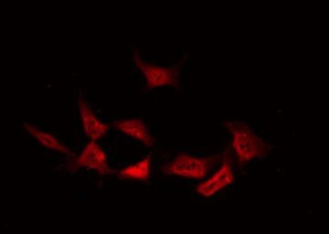 Phospho-PKC delta (Tyr64) Polyclonal Antibody, Invitrogen 100 μL ...