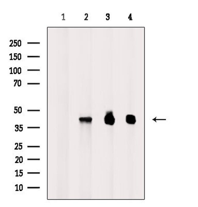 Phospho-p38 MAPK alpha (Tyr182) Polyclonal Antibody, Invitrogen 100 μL; | Fisher Scientific