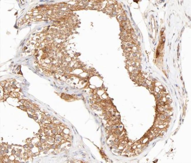 Invitrogen Phospho-IKK gamma (Ser31) Polyclonal Antibody 100 μL ...