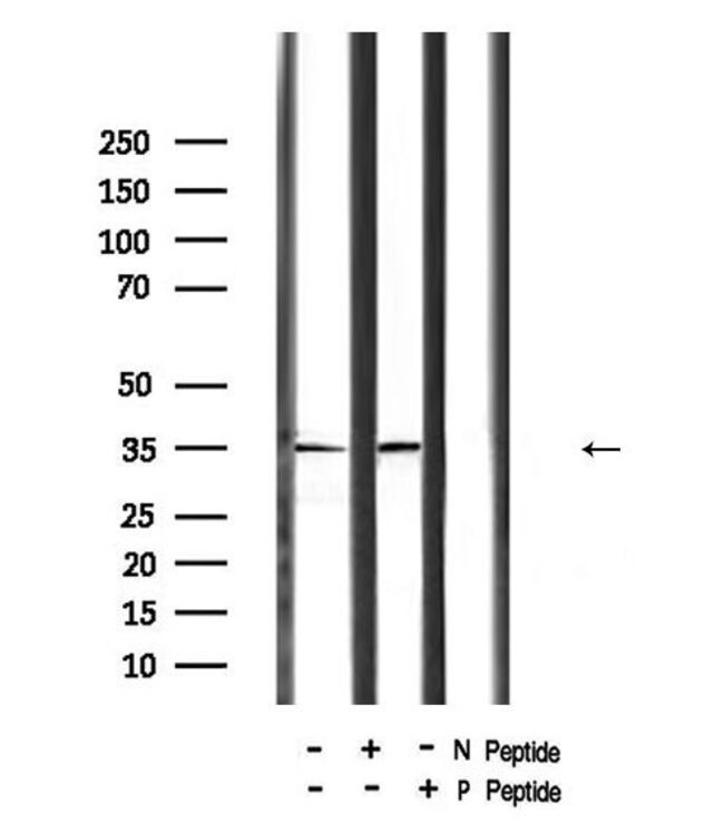 Phospho-PKA alpha (Ser338) Polyclonal Antibody, Invitrogen 100 μL; Unconjugated:Antibodies ...