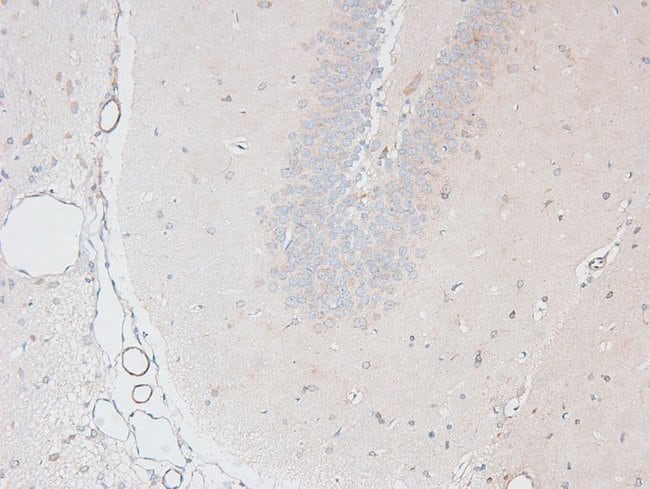 Phospho-MAX (Ser2) Polyclonal Antibody, Invitrogen 100 μL; Unconjugated ...