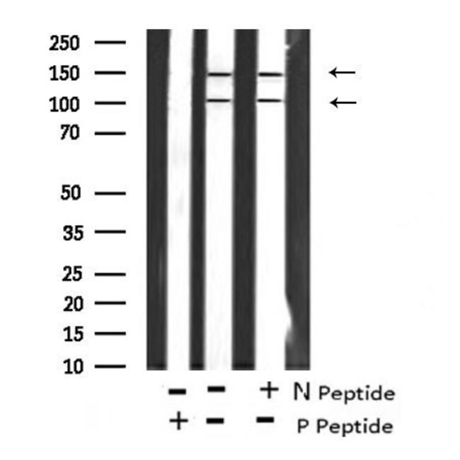 Phospho-IGF1R (Tyr980) Polyclonal Antibody, Invitrogen 100 μL ...