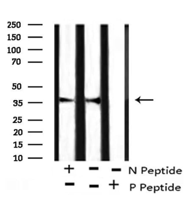 Phospho-AMPK beta-1 (Ser108) Polyclonal Antibody, Invitrogen 100 μL; | Fisher Scientific
