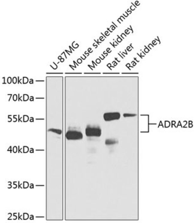 ADRA2B Rabbit anti-Human, Mouse, Rat, Unconjugated, Polyclonal ...