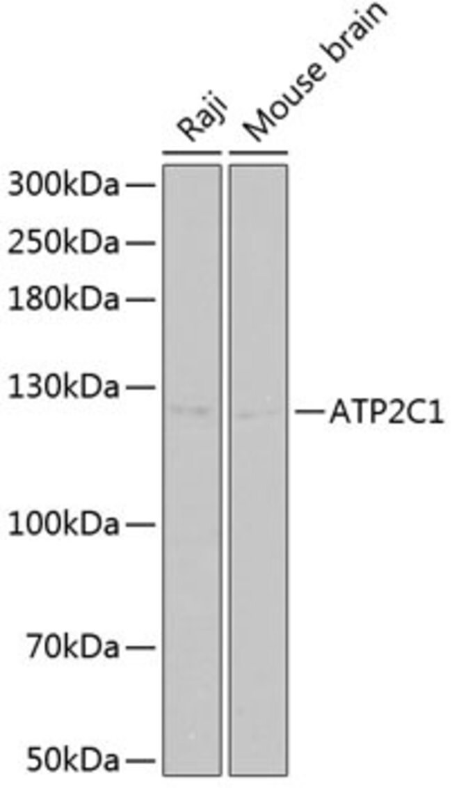 ATP2C1 Polyclonal Antibody, Invitrogen 100 μL; Unconjugated:Antibodies ...