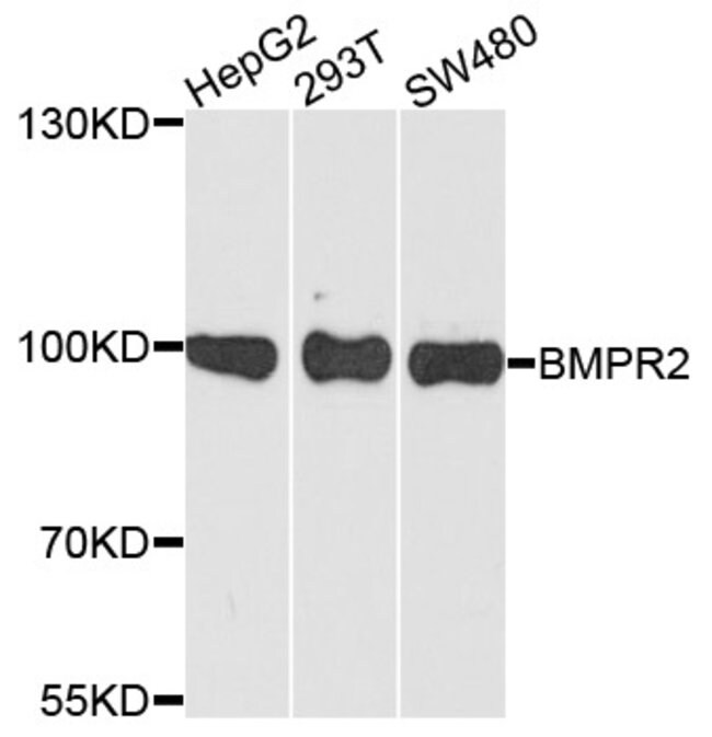 BMPR2 Polyclonal Antibody, Invitrogen™ 100 μL; Unconjugated | Fisher ...