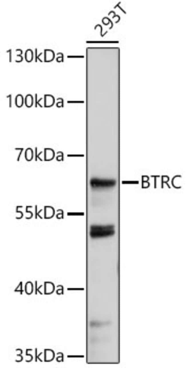 BTRC Polyclonal Antibody, Invitrogen 100 μL; Unconjugated:Antibodies ...
