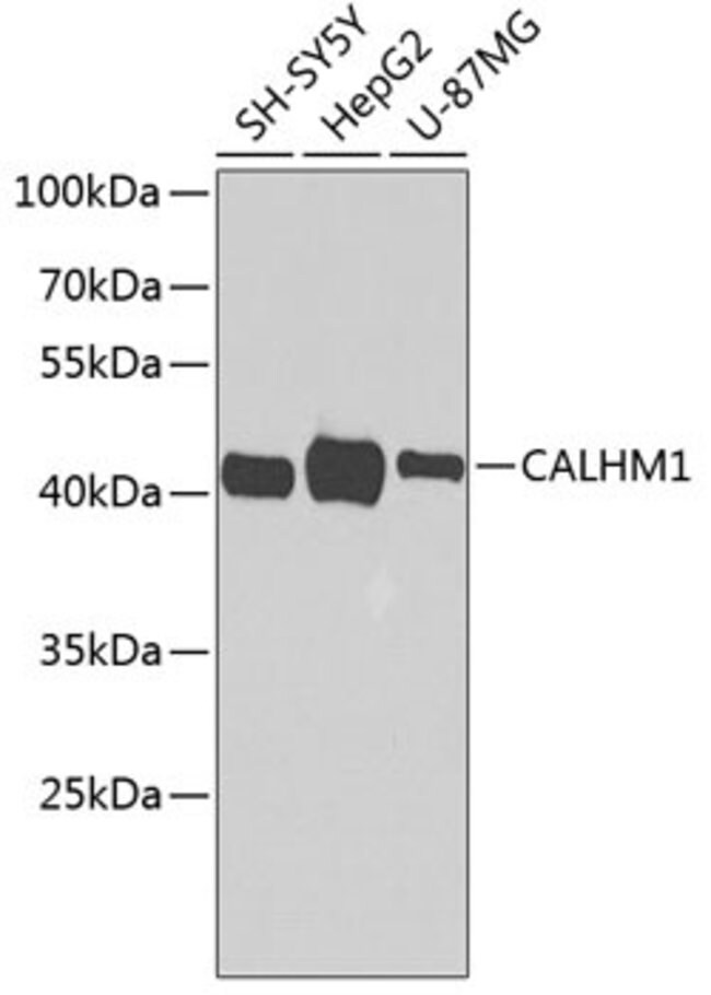 CALHM1 Rabbit anti-Human, Rat, Unconjugated, Polyclonal, Invitrogen 100 ...