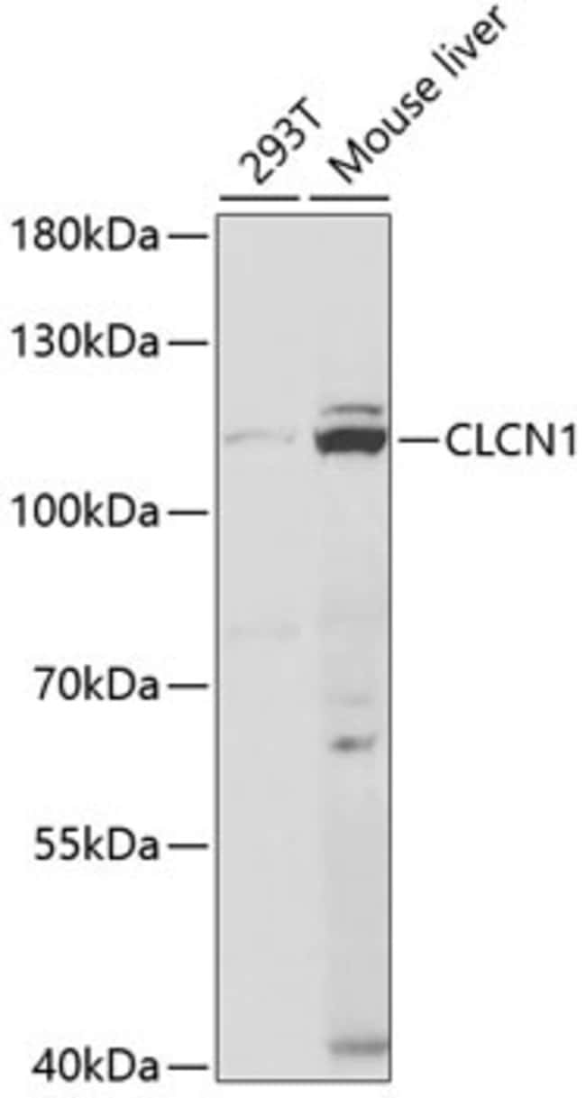 CLCN1 Rabbit anti-Human, Mouse, Unconjugated, Polyclonal, Invitrogen ...