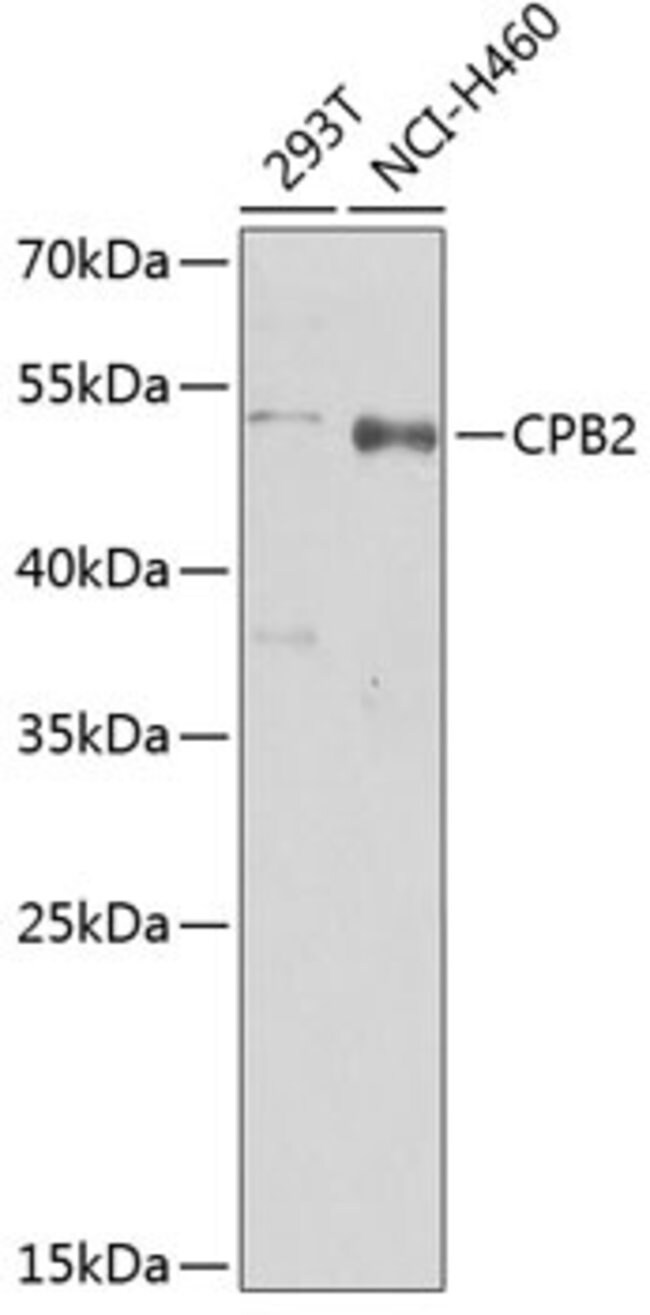 CPB2 Rabbit anti-Human, Unconjugated, Polyclonal, Invitrogen 100 μL ...