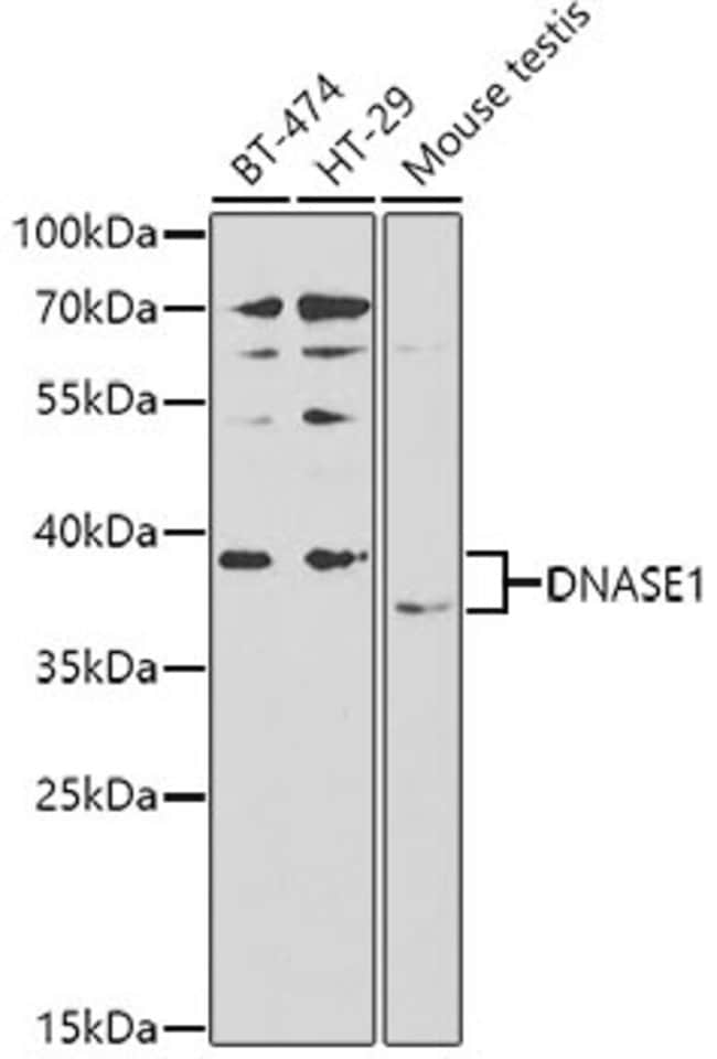 DNase I Polyclonal Antibody, Invitrogen 100 μL; Unconjugated:Antibodies ...