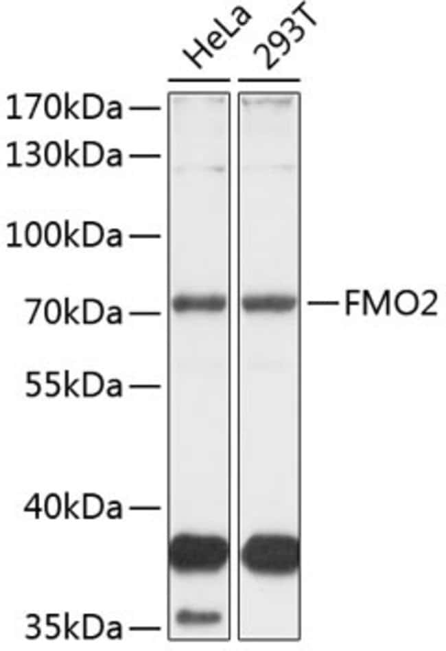 FMO2 Polyclonal Antibody, Invitrogen 100 μL; Unconjugated:Antibodies ...