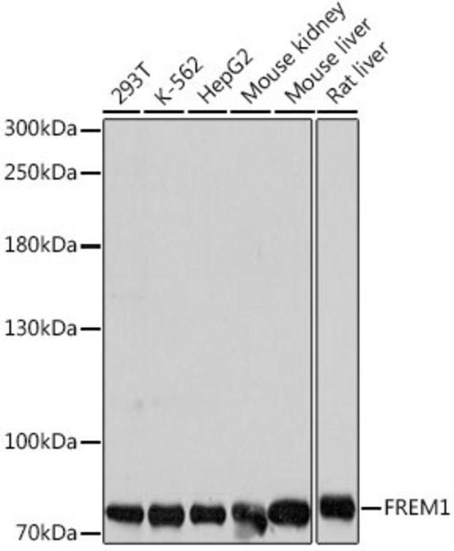 FREM1 Rabbit anti-Human, Mouse, Rat, Unconjugated, Polyclonal ...