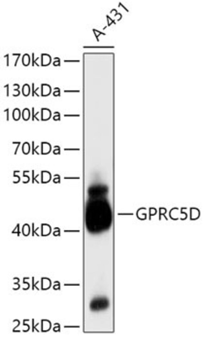 GPRC5D Polyclonal Antibody, Invitrogen 100 μL; Unconjugated:Antibodies ...