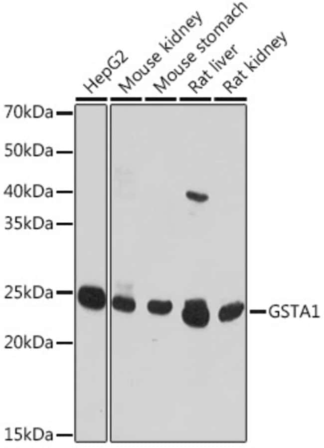 GSTA1 Rabbit anti-Human, Mouse, Rat, Unconjugated, Polyclonal ...