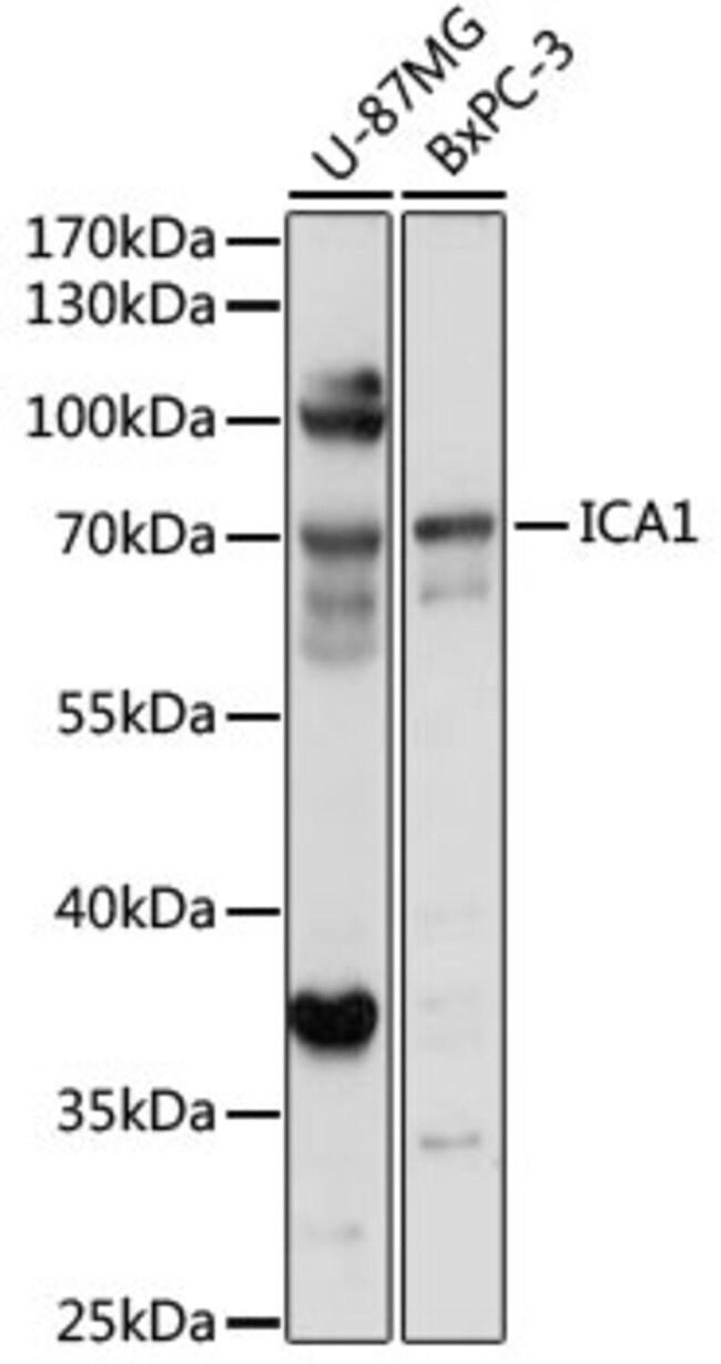 ICA1 Rabbit anti-Human, Unconjugated, Polyclonal, Invitrogen 100 μL ...