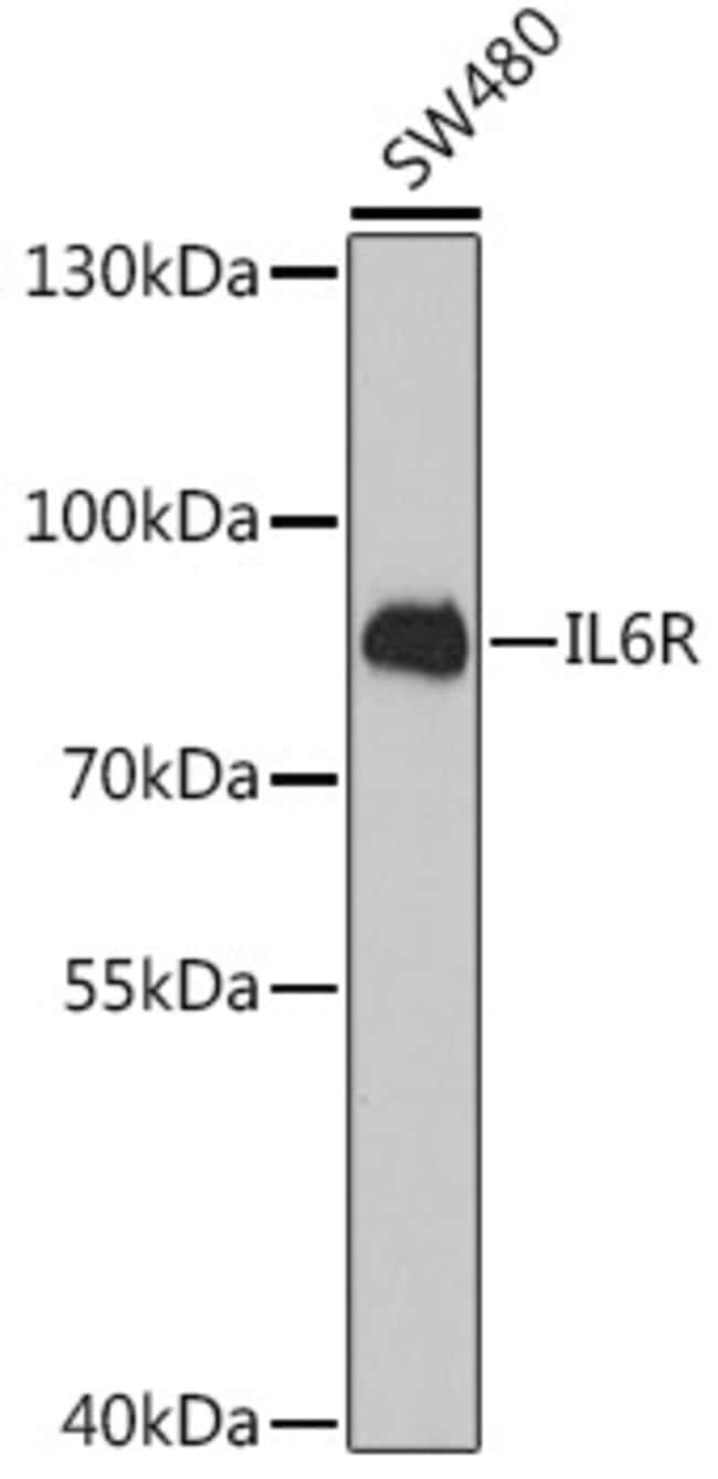IL6R Polyclonal Antibody, Invitrogen 100 μL; Unconjugated:Antibodies ...
