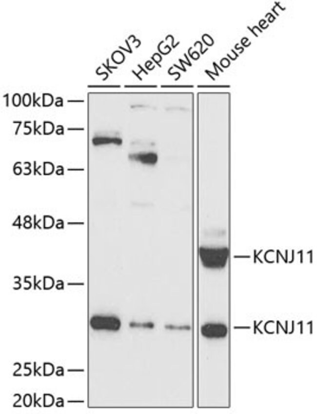 Kir6.2 (KCNJ11) Rabbit anti-Human, Mouse, Unconjugated, Polyclonal ...