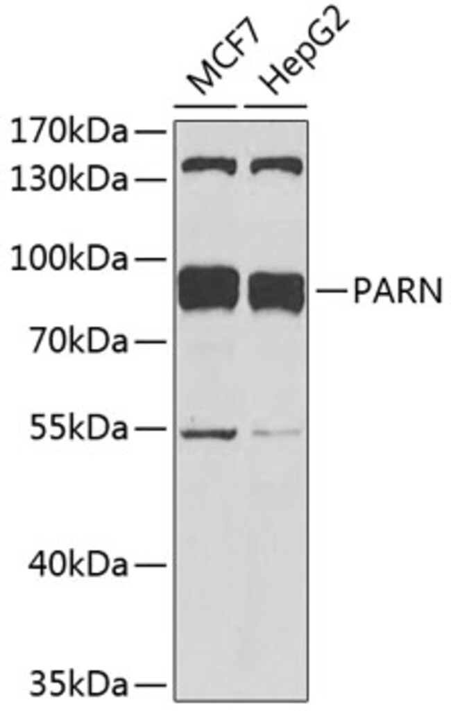 Invitrogen PARN Polyclonal Antibody 100 μL; Unconjugated:Antibodies ...