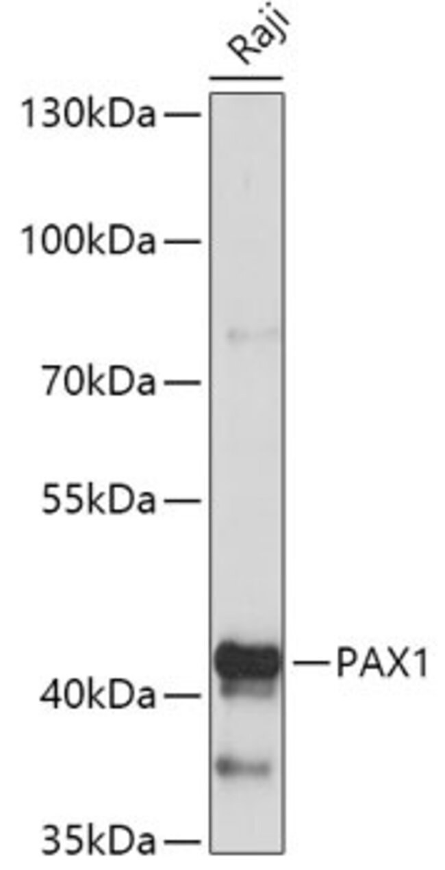 PAX1 Polyclonal Antibody, Invitrogen 100 μL; Unconjugated:Antibodies ...