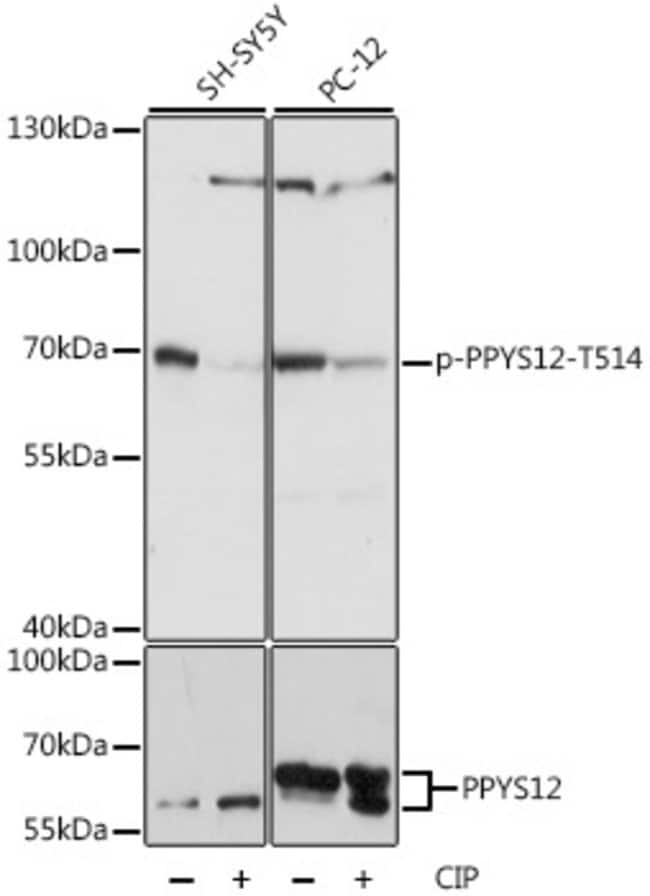 Phospho-CRMP2 (Thr514) Polyclonal Antibody, Invitrogen 100 μL; Unconjugated:Antibodies, | Fisher ...