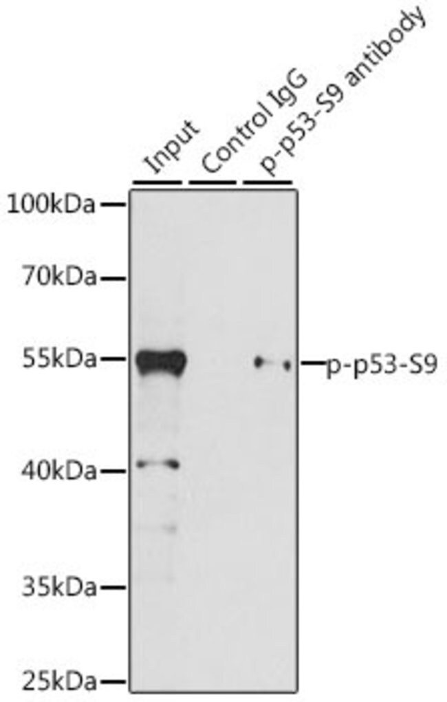 Phospho-p53 (Ser9) Polyclonal Antibody, Invitrogen 100 μL; Unconjugated:Antibodies, | Fisher ...