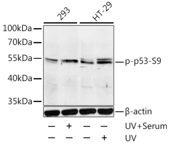Phospho-p53 (Ser9) Polyclonal Antibody, Invitrogen 100 μL; Unconjugated ...