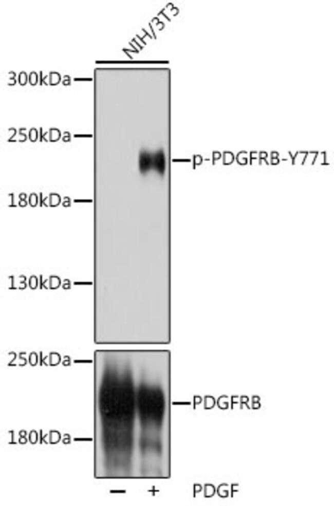 Phospho-PDGFRB (Tyr771) Polyclonal Antibody, Invitrogen 100 μL; Unconjugated:Antibodies ...