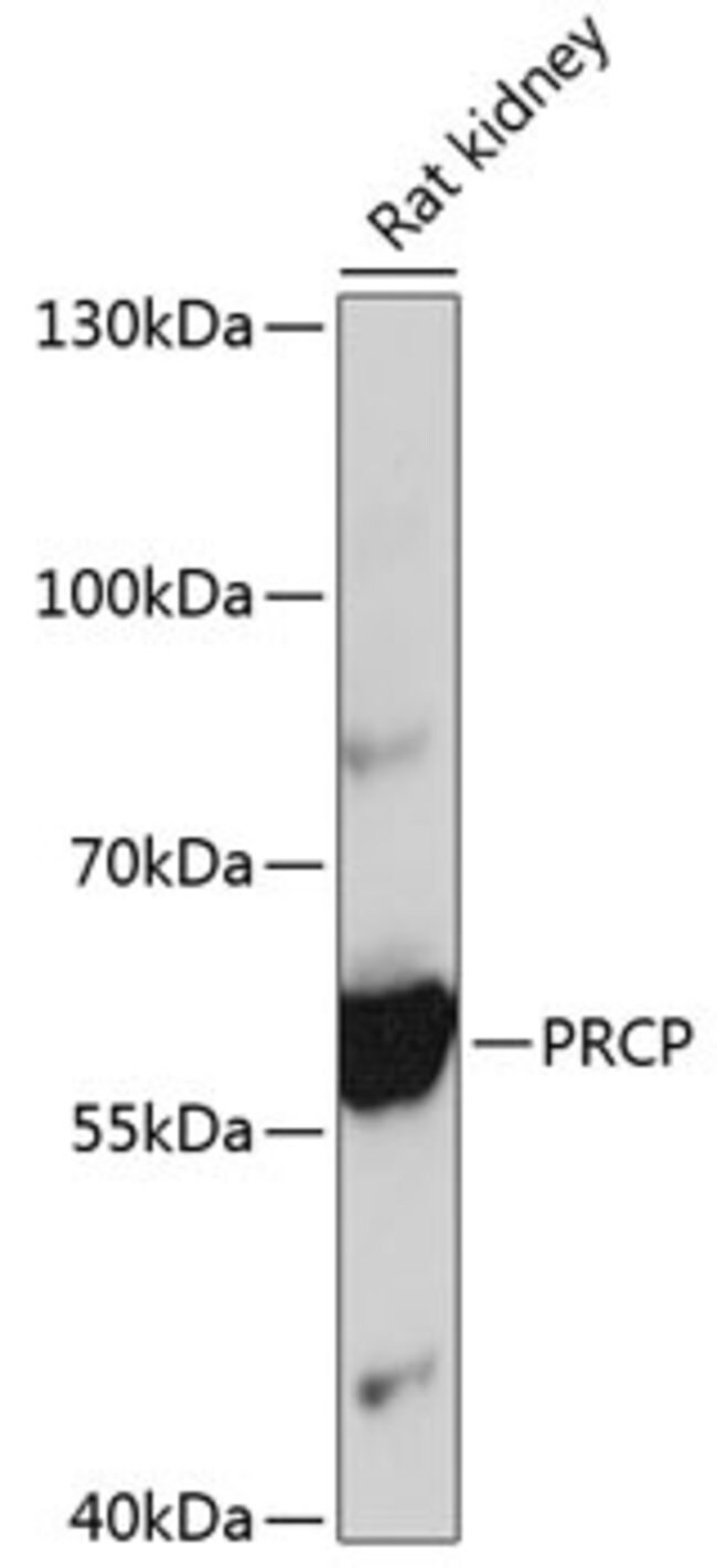 PRCP Polyclonal Antibody, Invitrogen 100 μL; Unconjugated:Antibodies ...