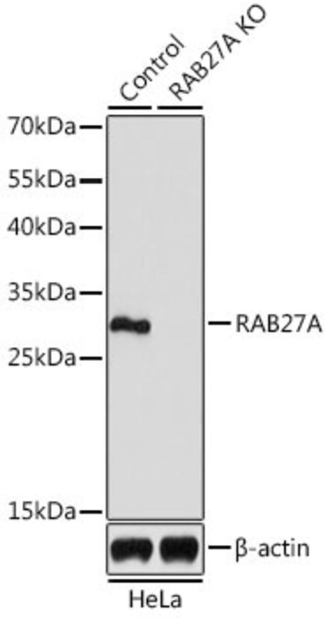 RAB27A Rabbit anti-Human, Mouse, Unconjugated, Polyclonal, Invitrogen ...