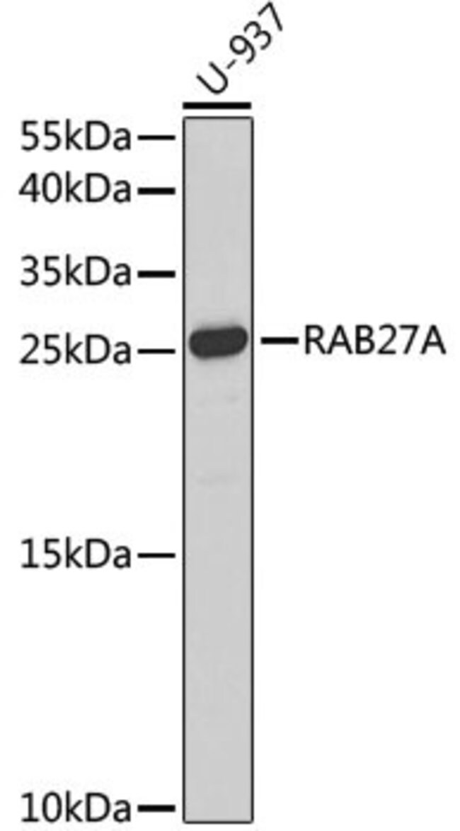 RAB27A Rabbit anti-Human, Mouse, Unconjugated, Polyclonal, Invitrogen ...