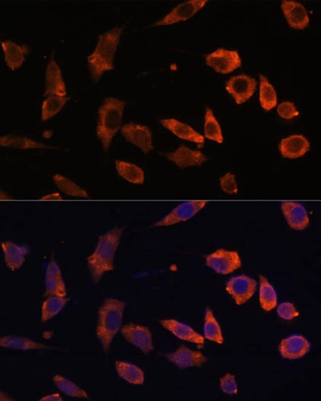 RAB5B Rabbit anti-Human, Mouse, Rat, Unconjugated, Polyclonal ...