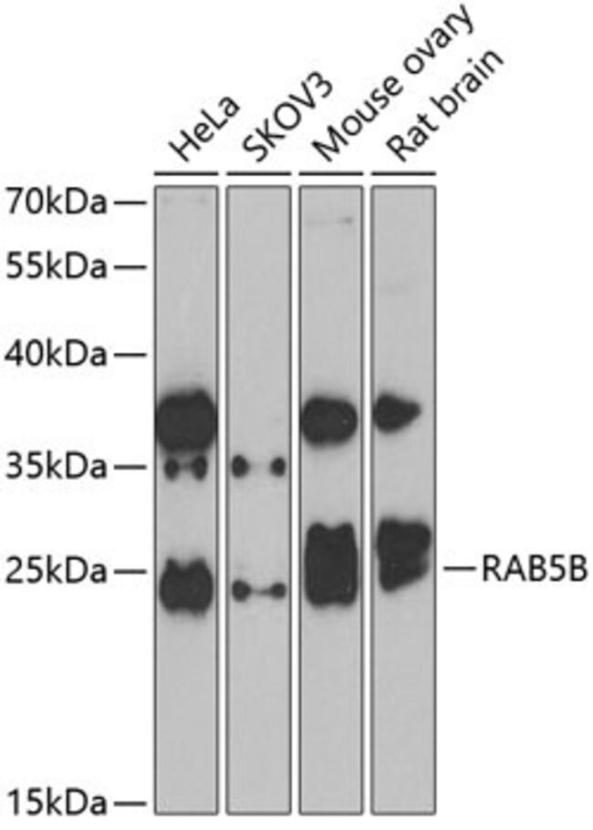 RAB5B Rabbit anti-Human, Mouse, Rat, Unconjugated, Polyclonal ...