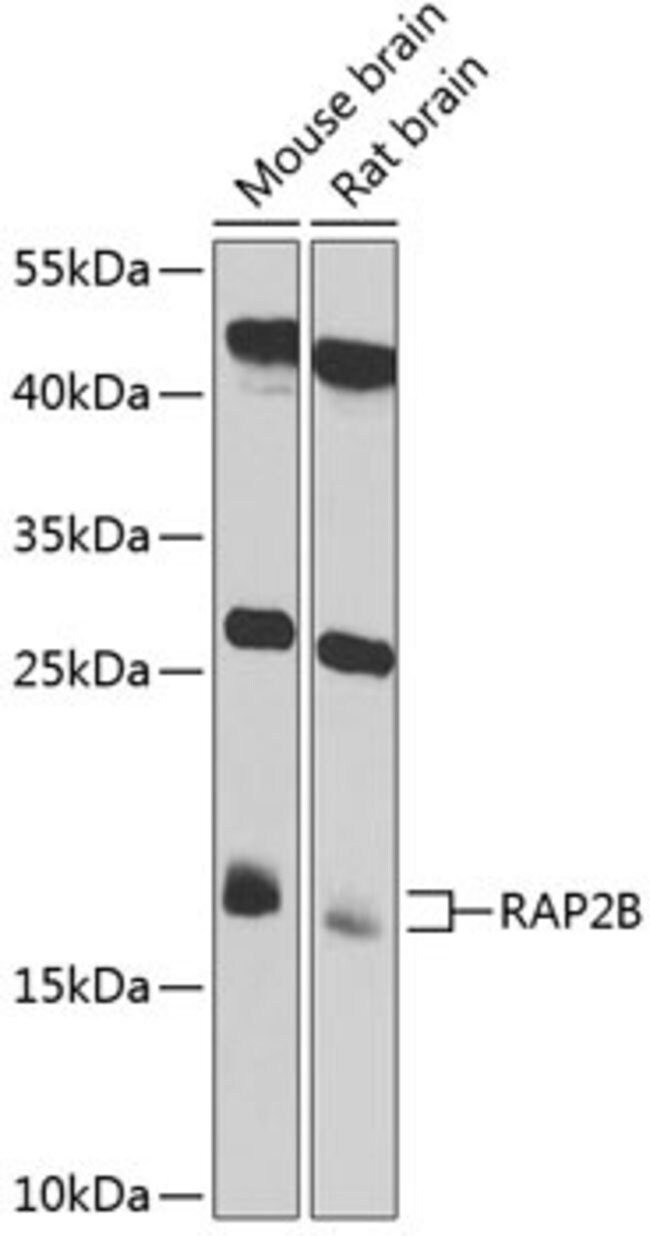 RAP2B Rabbit anti-Human, Mouse, Rat, Unconjugated, Polyclonal ...