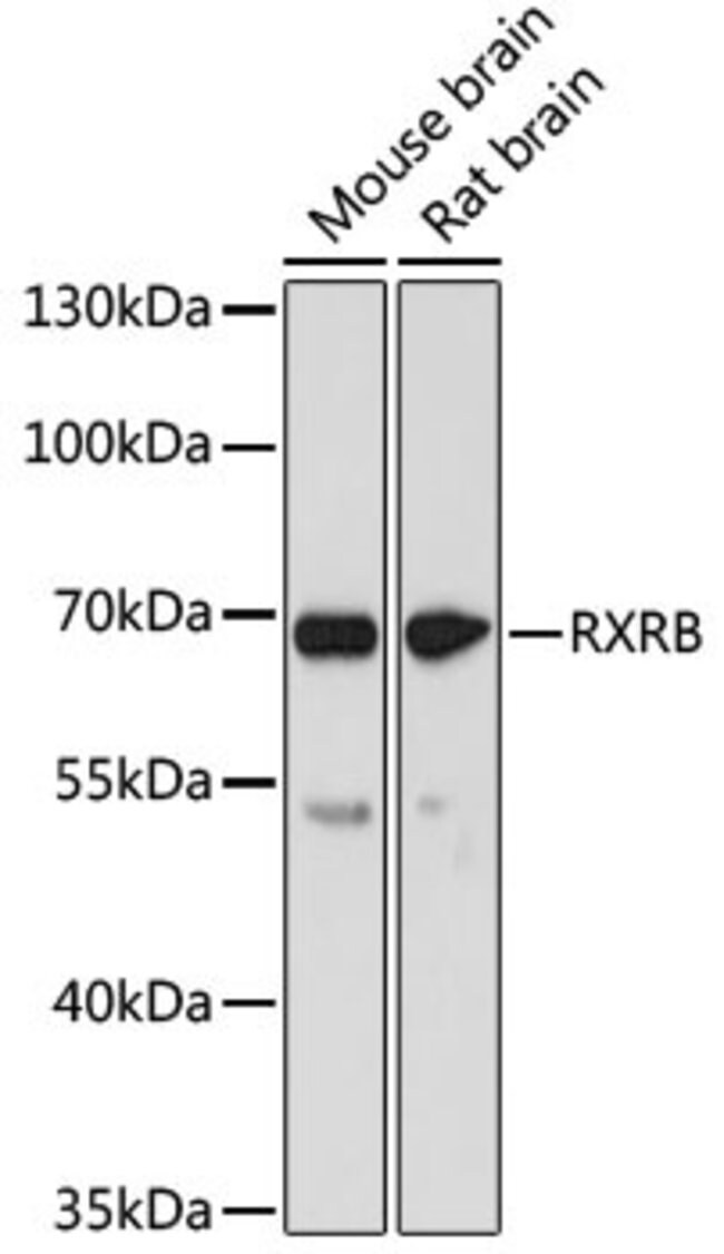 RXRB Rabbit anti-Human, Mouse, Rat, Unconjugated, Polyclonal ...