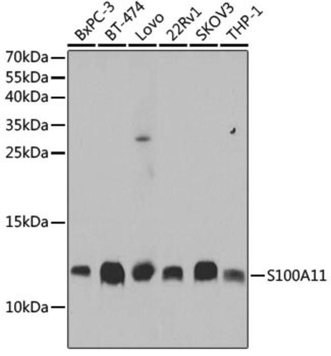 S100A11 Rabbit anti-Human, Unconjugated, Polyclonal, Invitrogen 100 μL ...