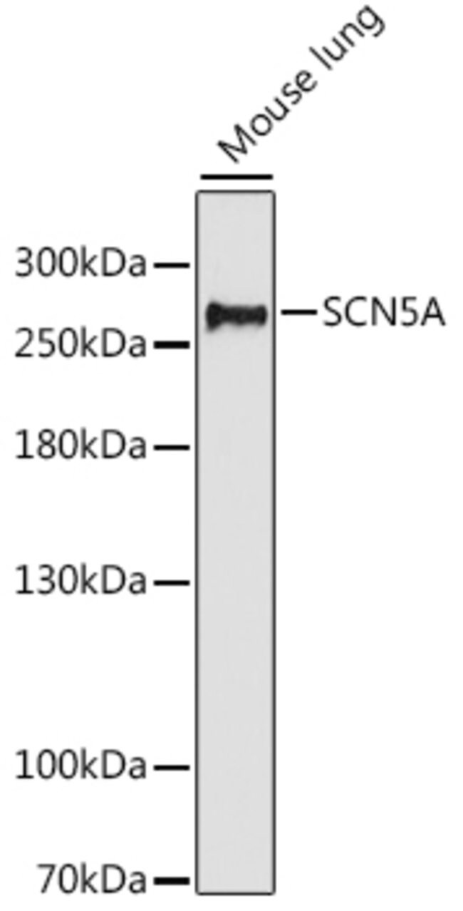 SCN5A Rabbit anti-Mouse, Unconjugated, Polyclonal, Invitrogen 100 μL ...