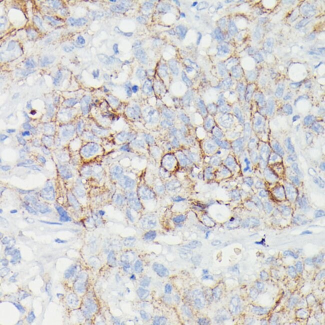 SLC14A1 Polyclonal Antibody, Invitrogen 100 μL; Unconjugated:Antibodies ...