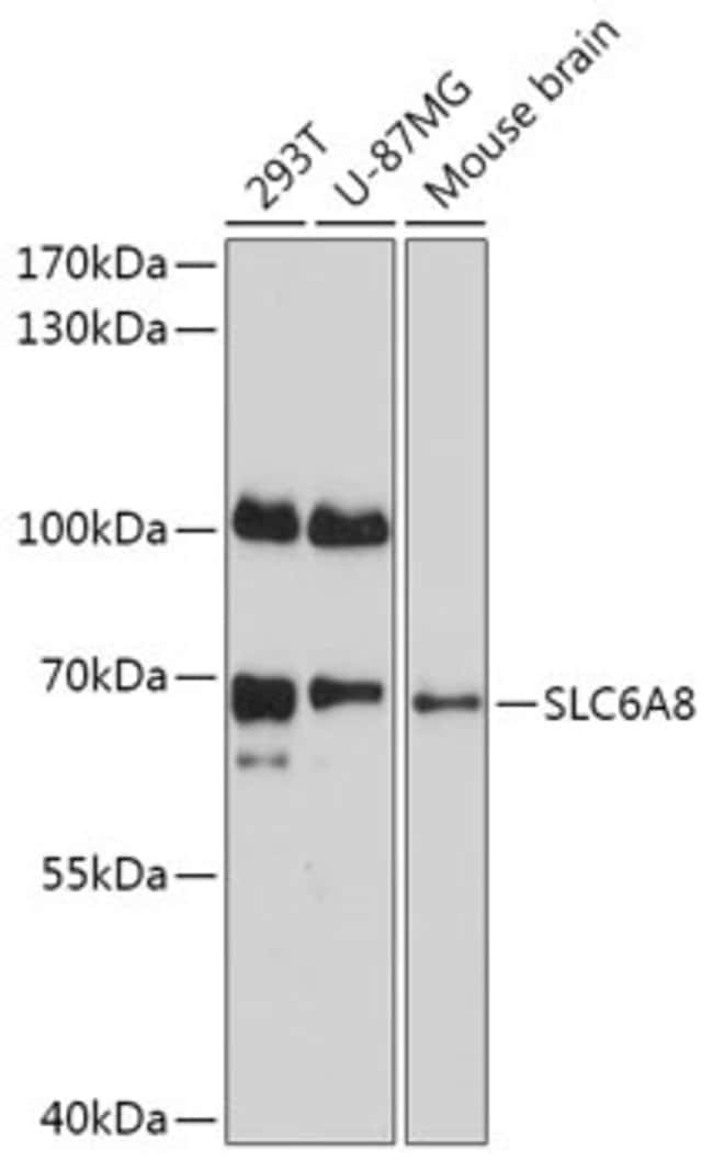 SLC6A8 Polyclonal Antibody, Invitrogen 100 μL; Unconjugated:Antibodies ...